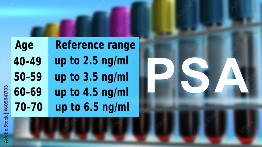 PSA analyses. Prostate disease. PSA logo near test tubes. Medical table ...