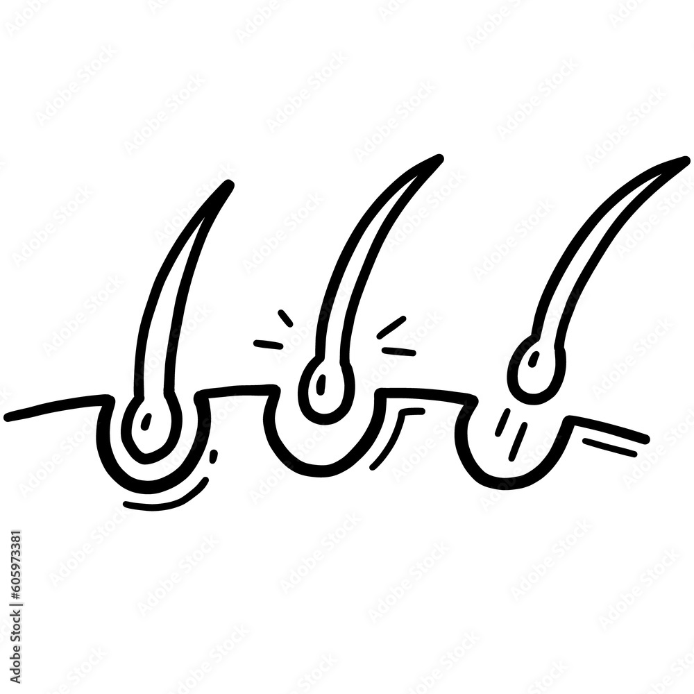 Skin with hair root removal, hair follicles, doodle cartoon icon Stock ...