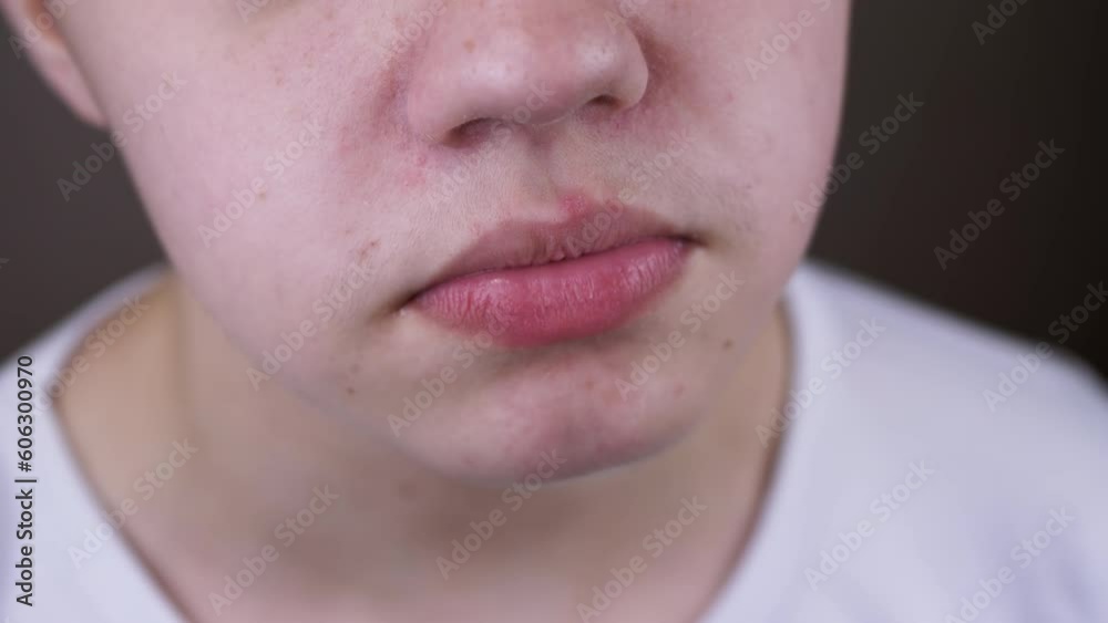Wideo Stock: Close up, Child Chews Chewing Gum, then Stretch it Out of ...