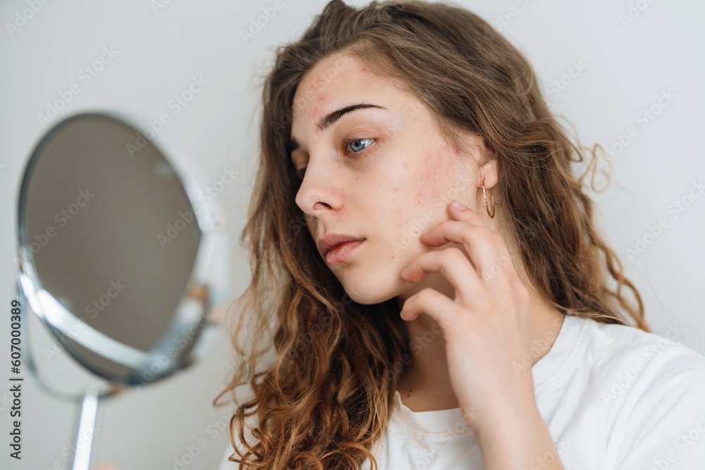 Beautiful woman with problem skin looking into mirror. Dermatology ...