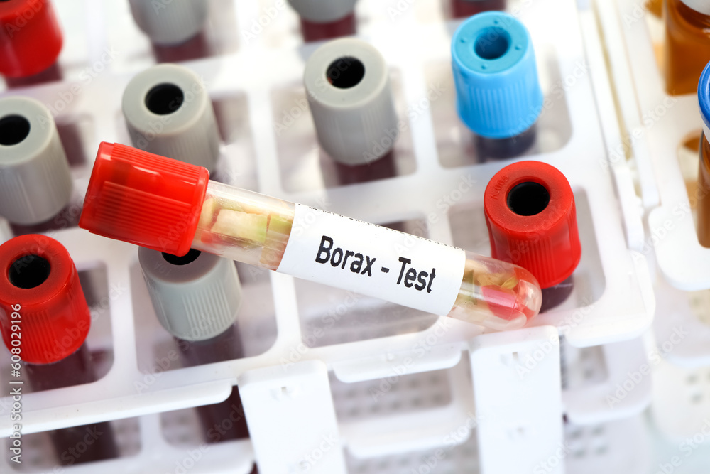 Borax test, food sample to analyze in the laboratory Stock Photo ...