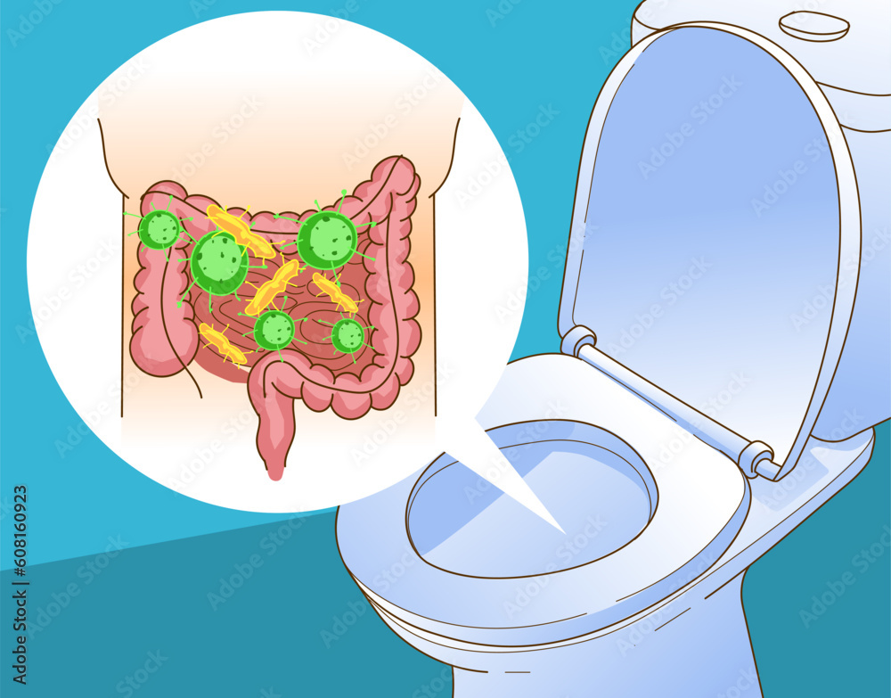 Dairea. Stool chart. Bacteria in the gut. Health problems. Medical ...