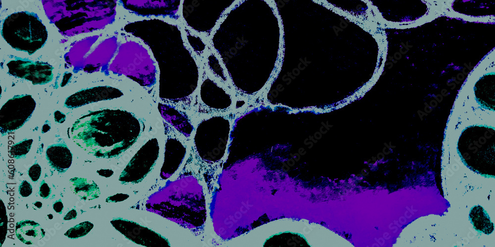 Cell Virus. Multicolored Human Leukocyte Antigen. Bright Microscope ...