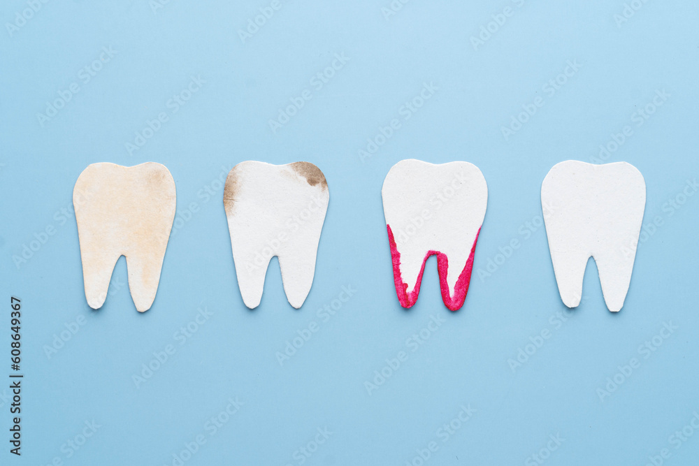 Dental problems cartoon made from paper. Set of teeth with different ...