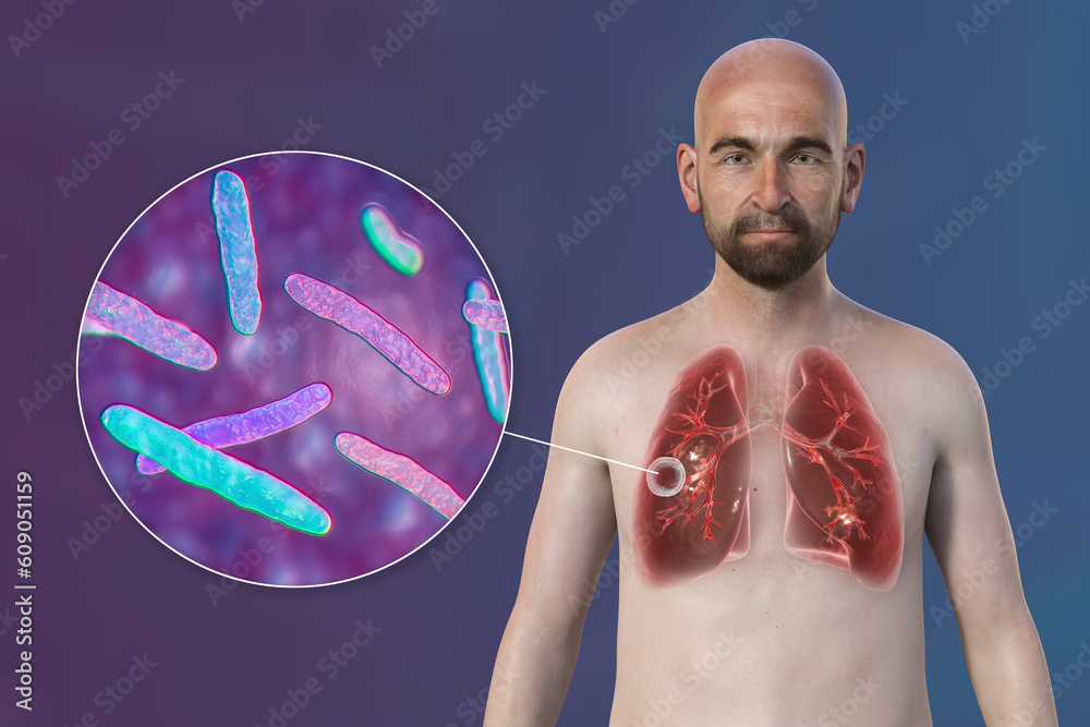 A 3D illustration of a man with transparent skin, showcasing the lungs ...