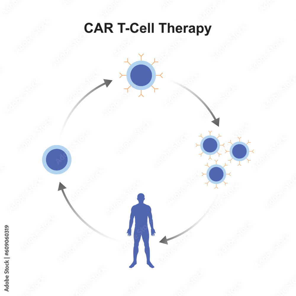 Scientific Designing of CAR T-cell Therapy. Vector Illustration. Stock ...