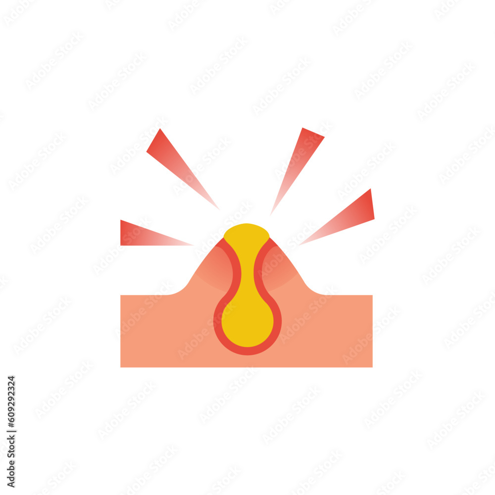 Acne icon. Pimple on the skin. Diseases on the skin. Vector ...
