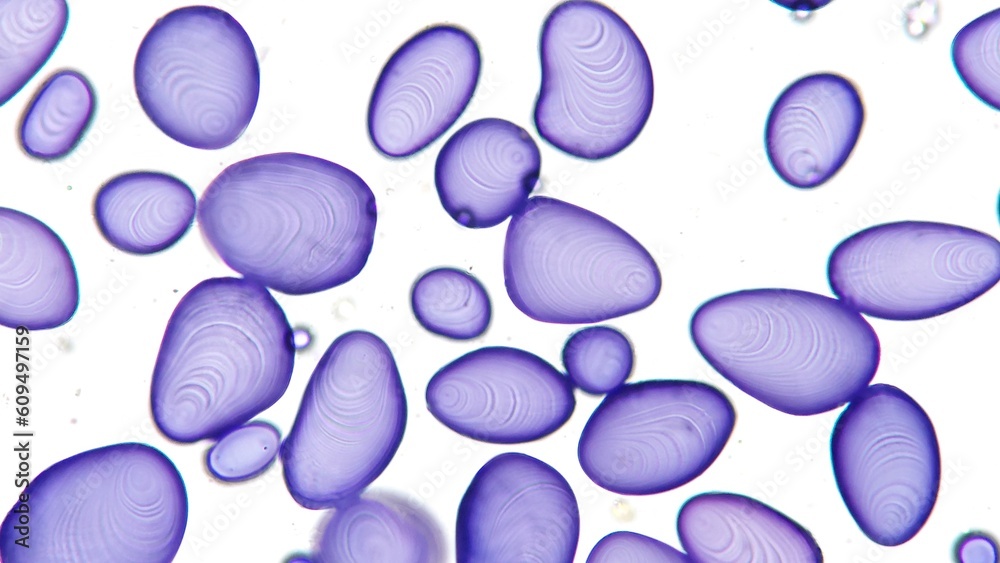 Starch grains of potato under microscope. 1000x magnification. Sample ...