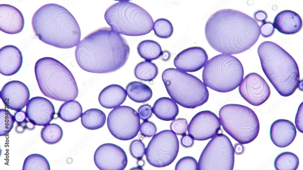 Starch grains of potato under microscope. 1000x magnification. Sample ...