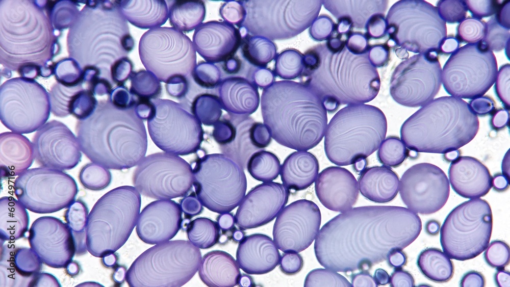 Starch grains of potato under microscope. 1000x magnification. Sample ...