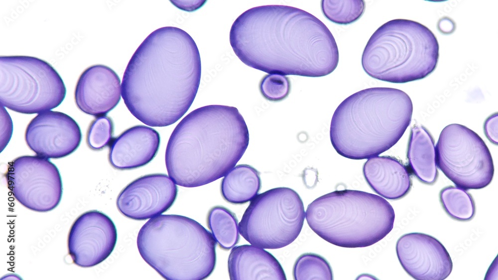 Starch grains of potato under microscope. 1000x magnification. Sample ...