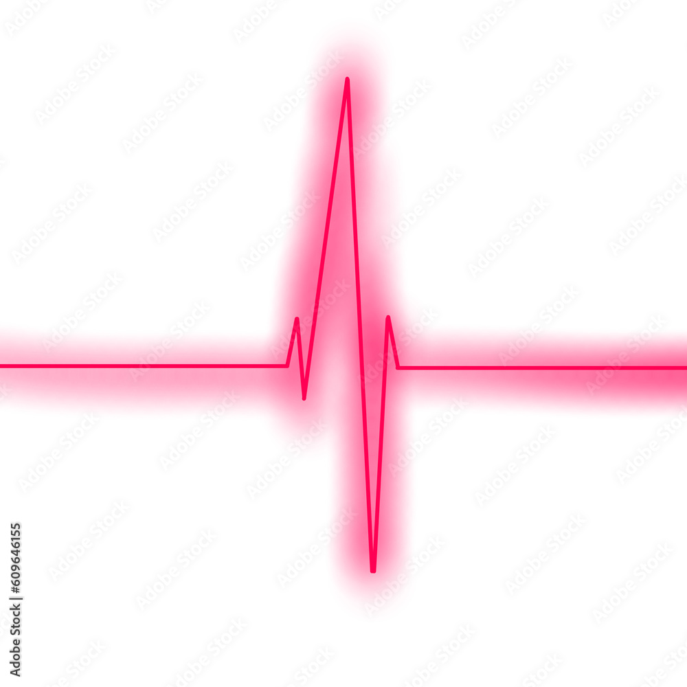 heart rate graph cardiac arrest , heart beat graph Stock Illustration ...