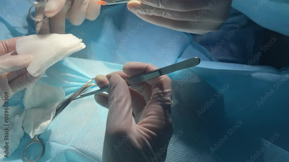 Surgery operation. Close up of surgery hands take off wadding tampon in ...