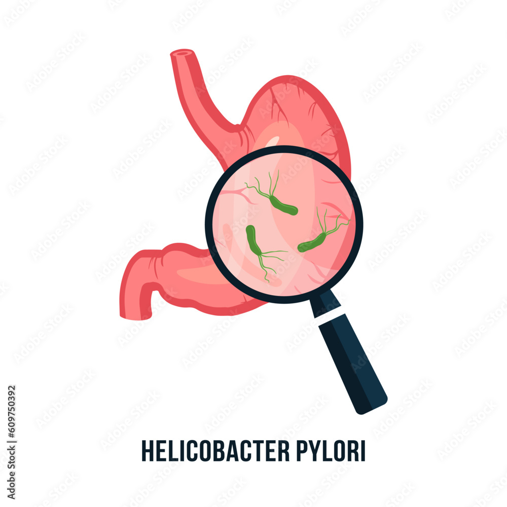 Magnifying glass with bacteria Helicobacter Pylori in the human stomach ...