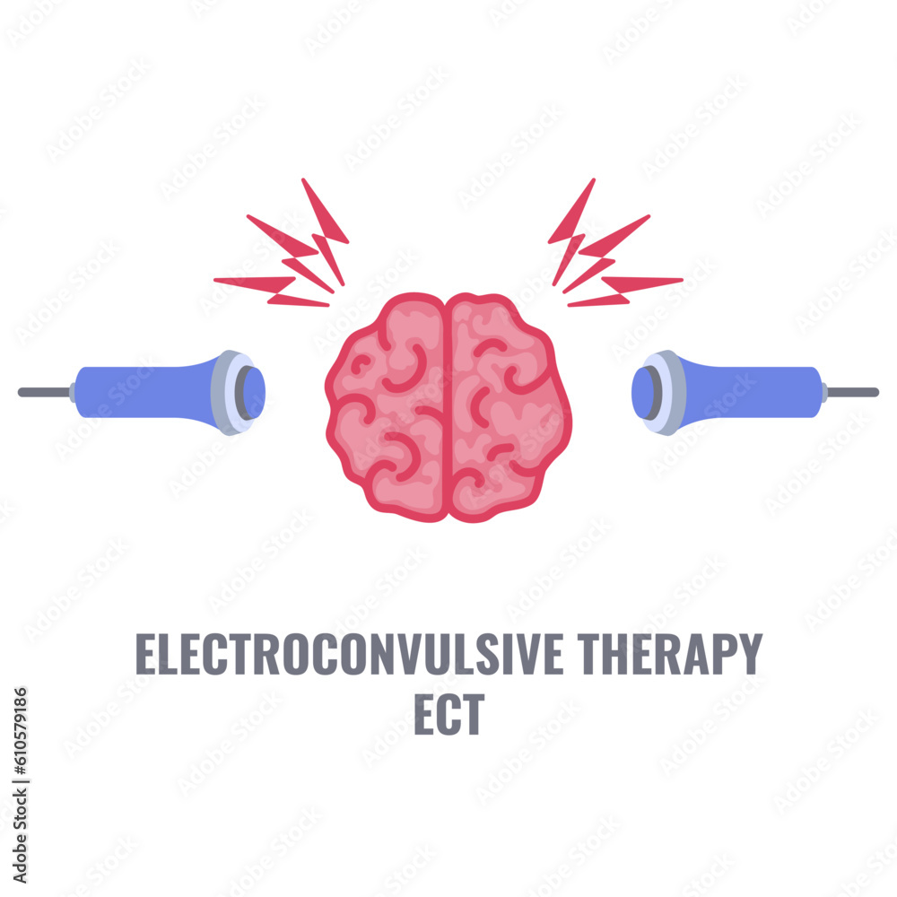 Electroconvulsive therapy for severe depression and schizophrenia ... Electroconvulsive therapy for severe depression and schizophrenia ...