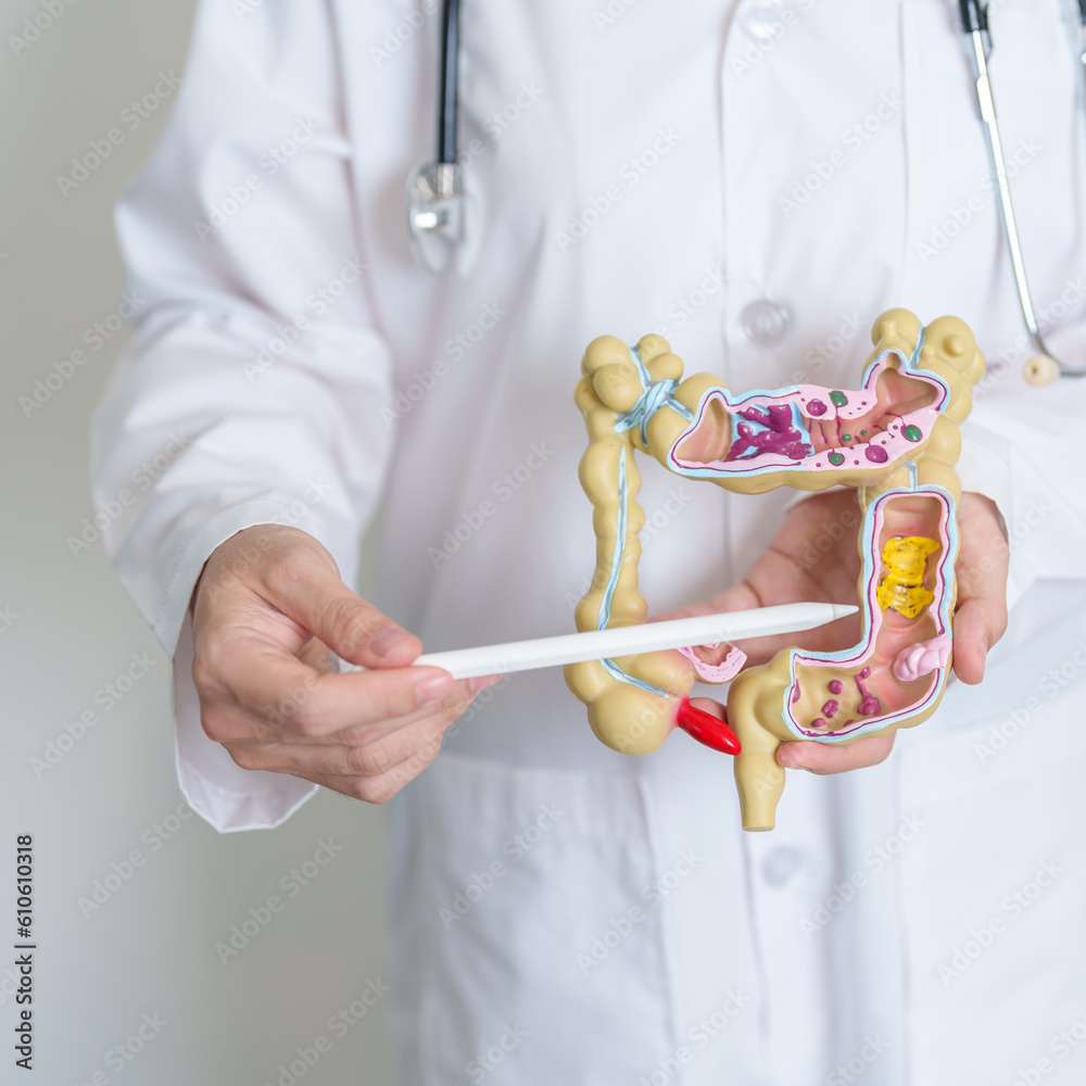 Doctor holding human Colon anatomy model. Colonic disease, Large ...