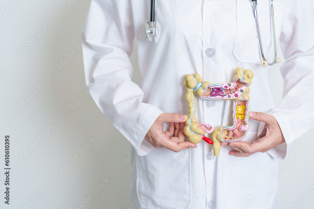 Doctor holding human Colon anatomy model. Colonic disease, Large ...