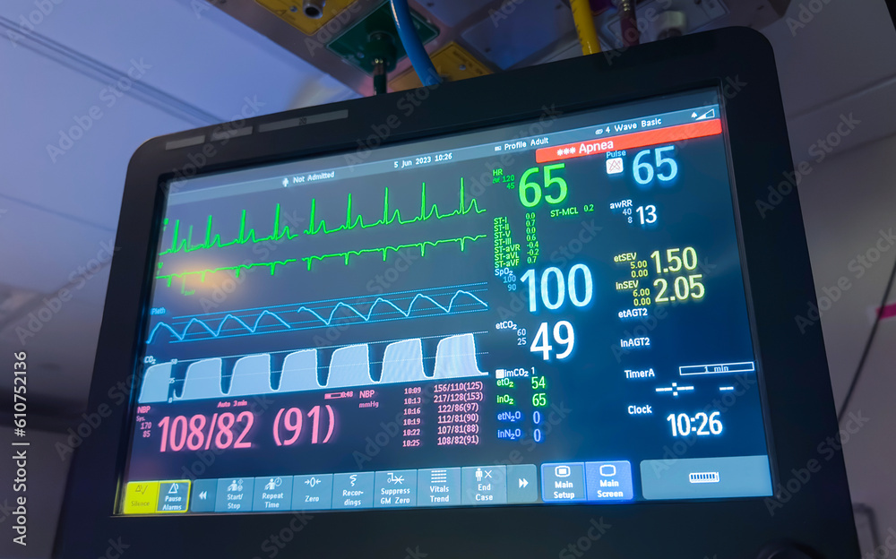 Hospital monitor symbolizes vital signs monitoring, patient health ...