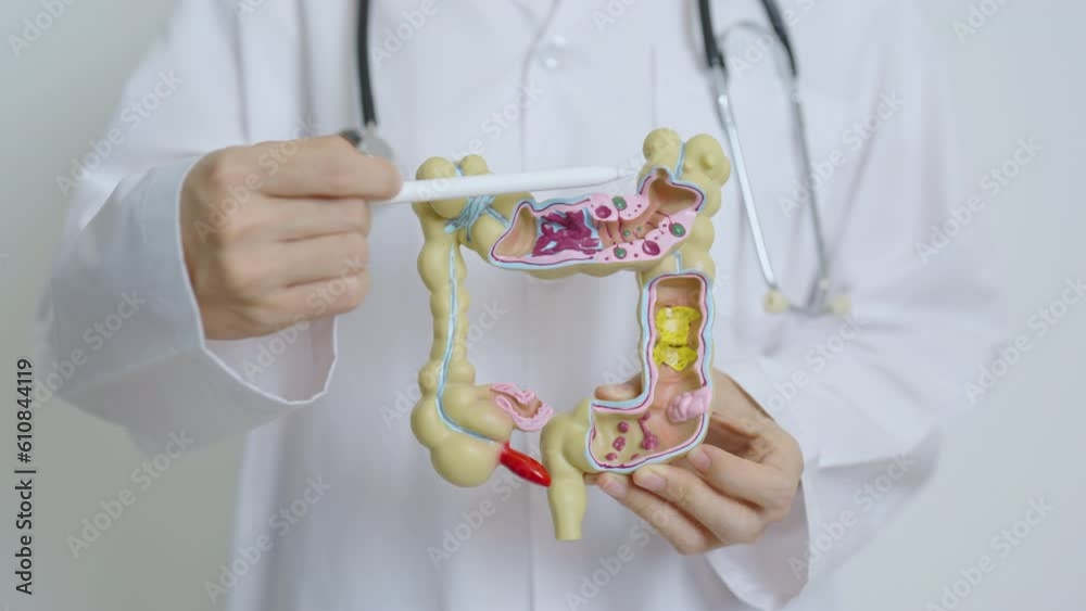 Doctor with human Colon anatomy model and tablet. Colonic disease ...