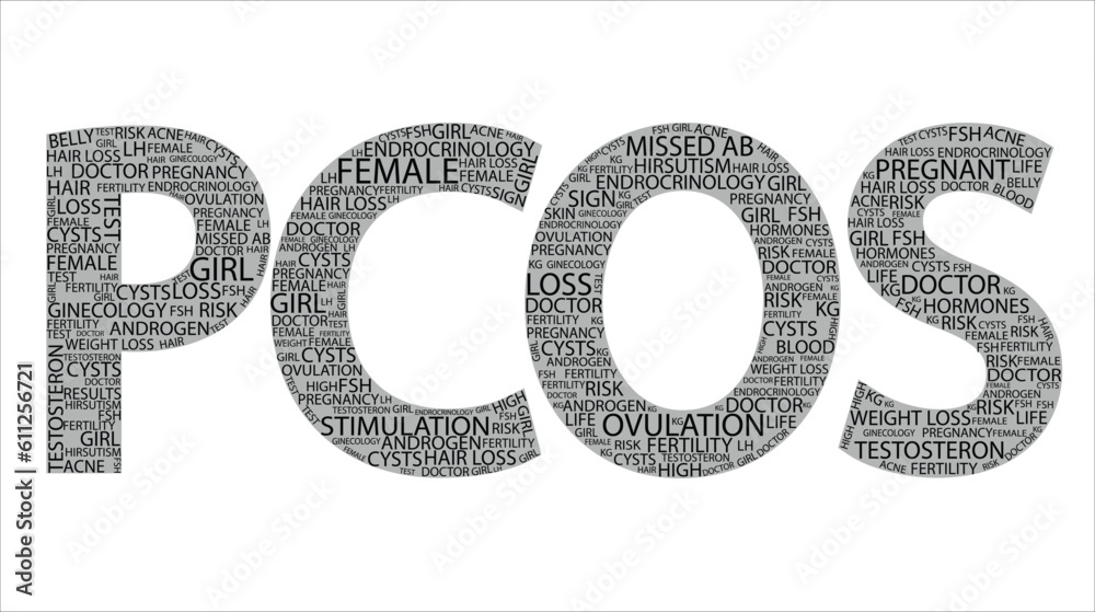 Polycystic ovary syndrome PCOS is a hormonal disorder common among ...