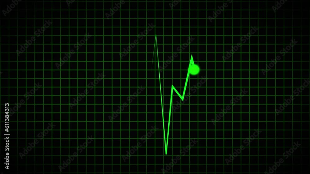 Vidéo Stock Heartbeat pulse rate line on green grid. Green heartbeat ...