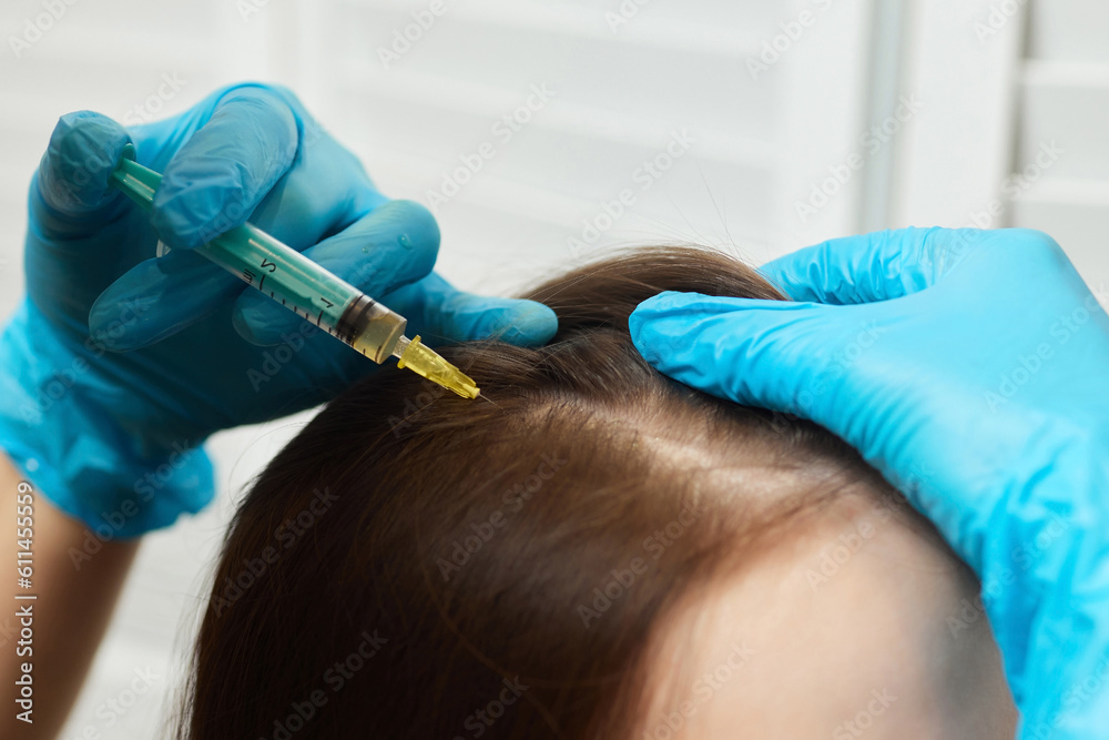 Plasma treatment, plasmolifting or PRP method point the introduction of ...