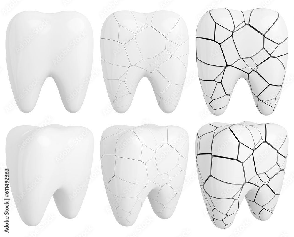 White glossy and fractured teeth set. Dentistry design elements ...