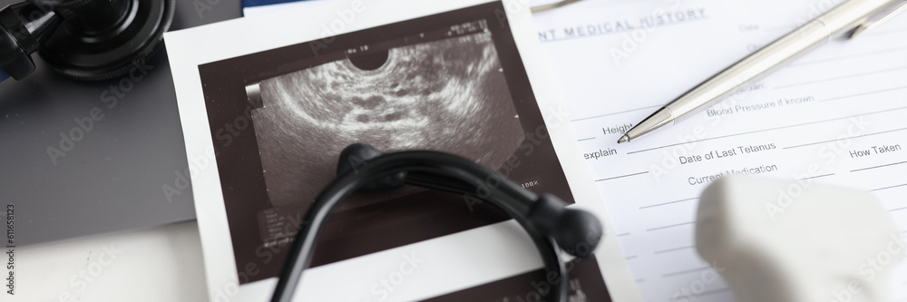 Modern ultrasound device with sensor and ultrasound of uterus. Medical ...