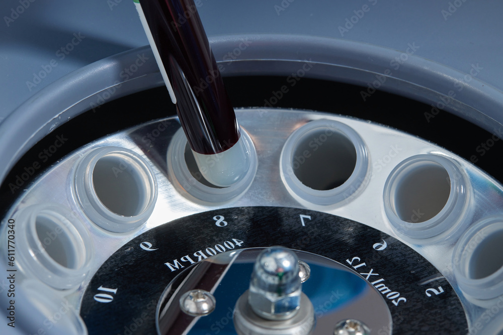Beautician doctor's hands put test tube with blood in centrifuge ...
