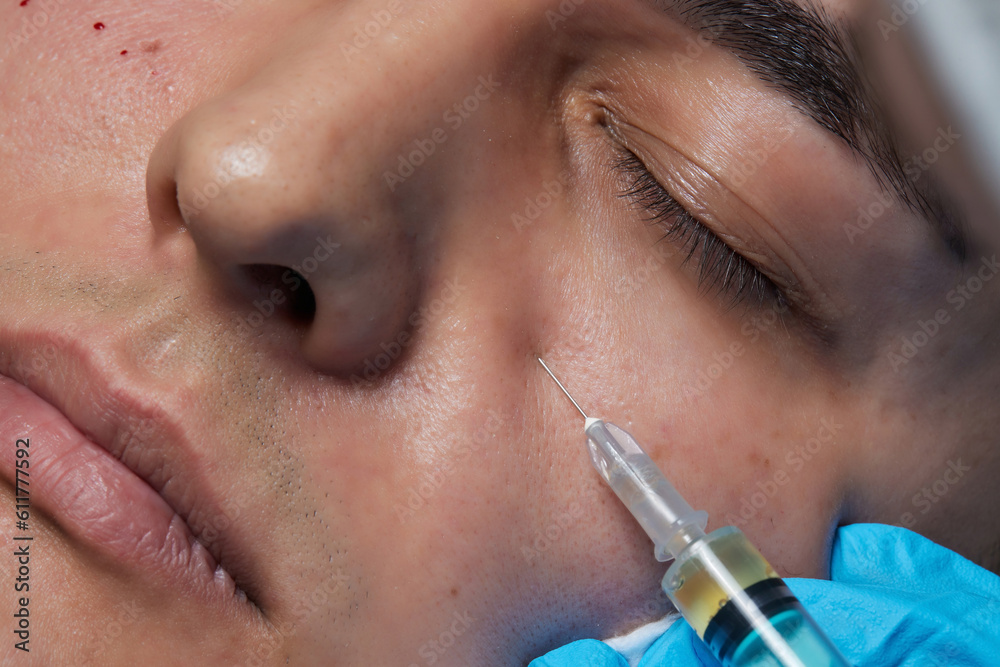 Injection at spa salon. Doctor hands in gloves. Closeup. Pretty male ...