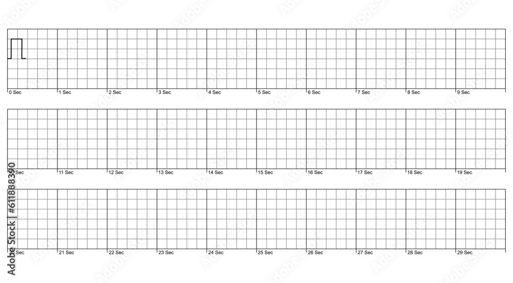 Electrocardiogram, ecg grid graph, Ruler grid vector illustration ...