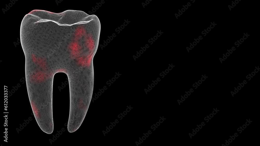 3D tooth Scan. Tooth Scanning Interface. HUD Tooth analyze. Medical ...
