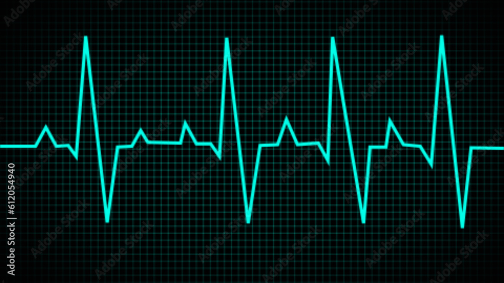 Emergency ekg monitoring, Electrocardiogram, heart rhythm set, ECG ...