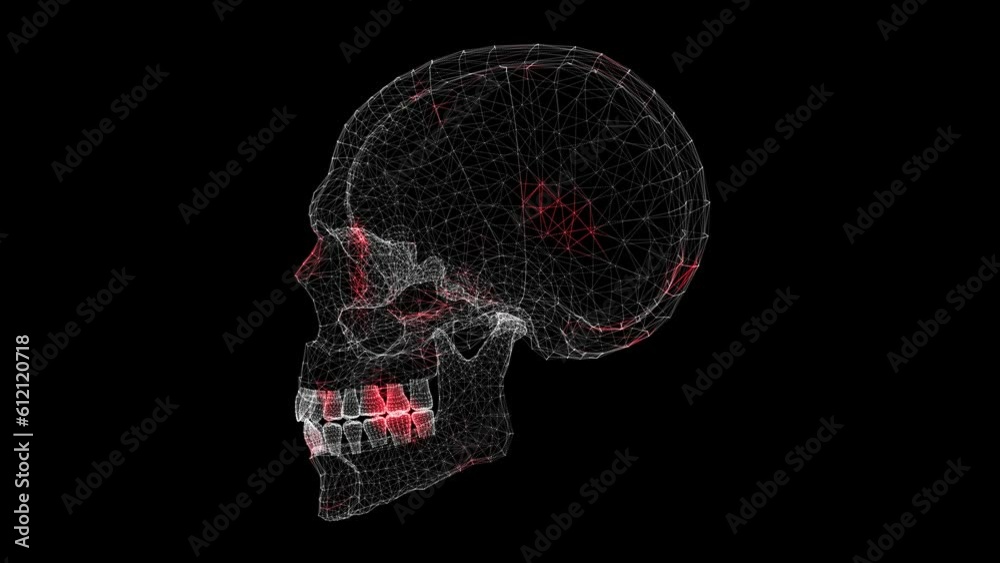 Spread of virus through 3D human skull on black background. Visual ...