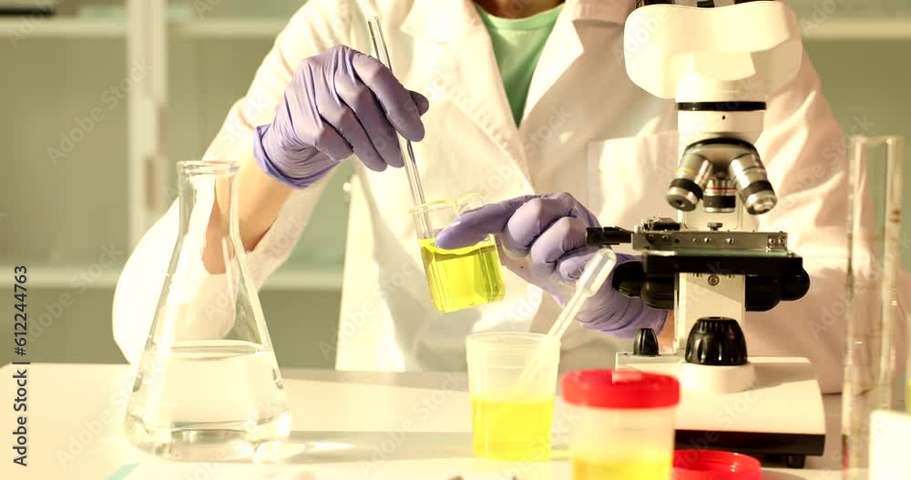 Urine sample medical analysis scientist stirs analysis in beaker. Urine ...