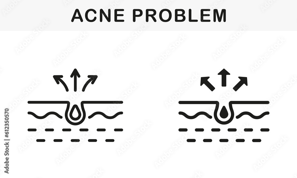 Skin Acne, Pimple, Comedo Pictogram. Blackhead and Inflammation Sebum ...