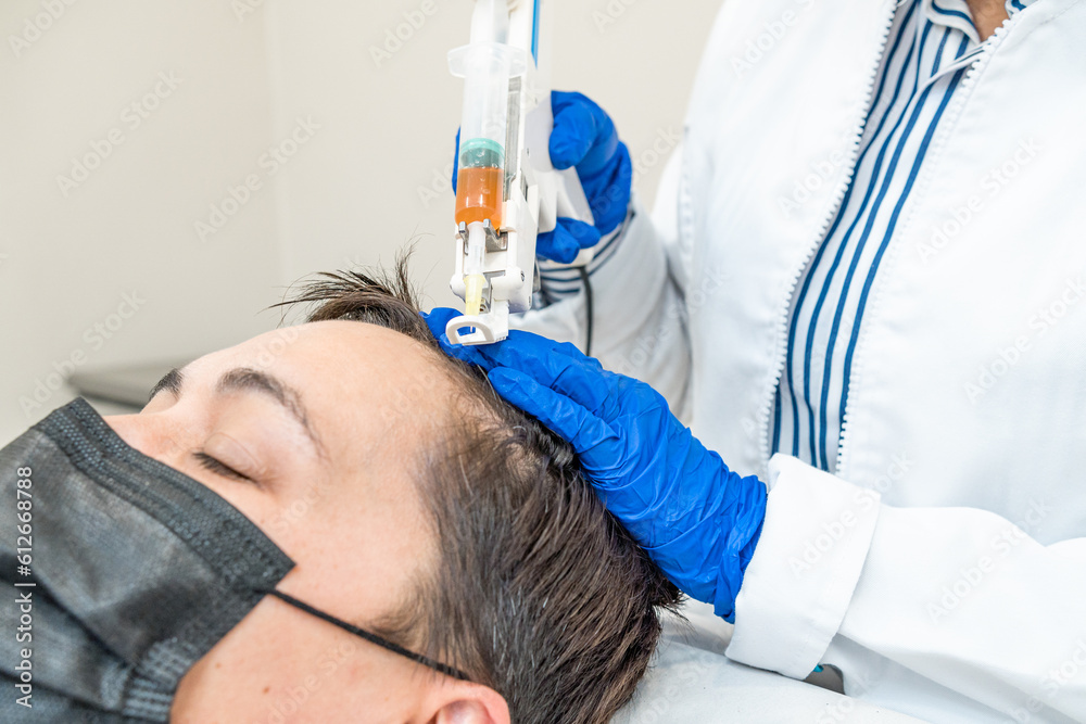 doctor injecting blood plasma into the scalp Stock Photo | Adobe Stock
