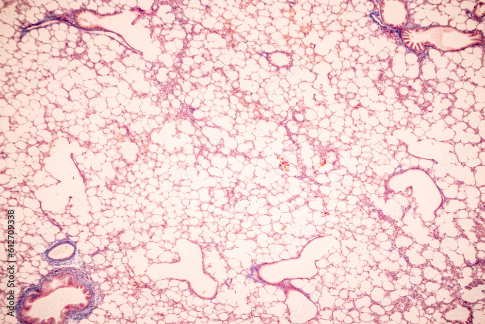 Human lung pathology under light microscope, The lungs is organs of the ...