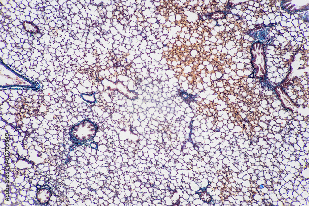 Human lung pathology under light microscope, The lungs is organs of the ...