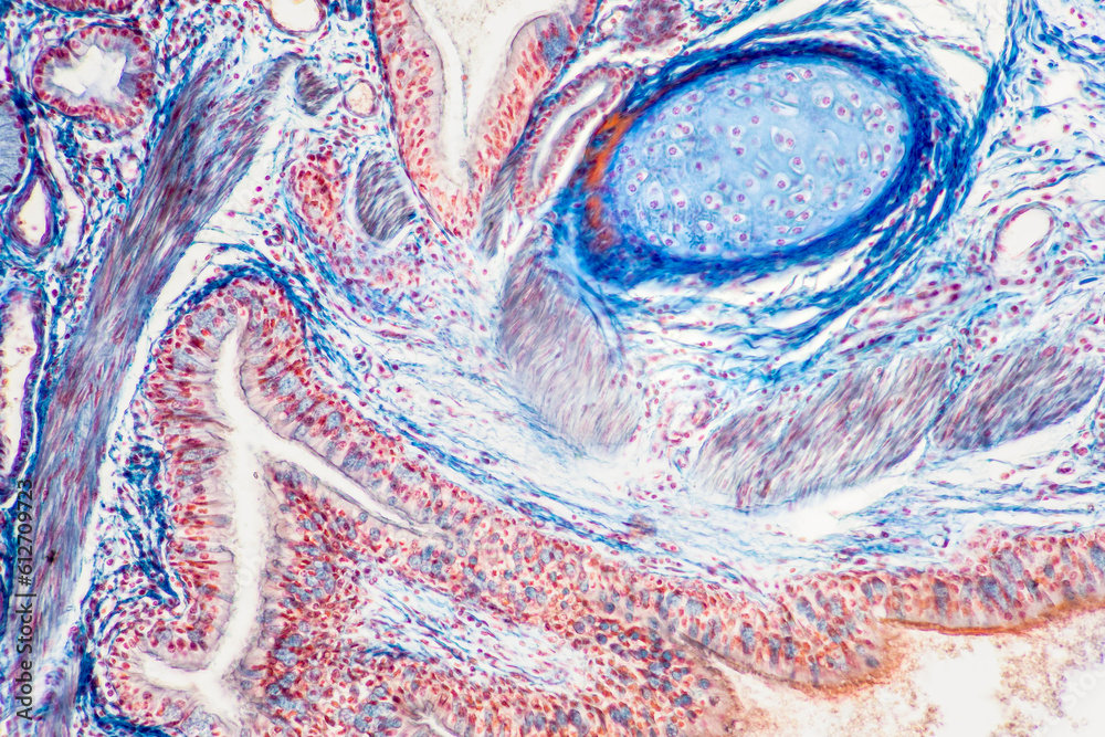 Human lung pathology under light microscope, The lungs is organs of the ...