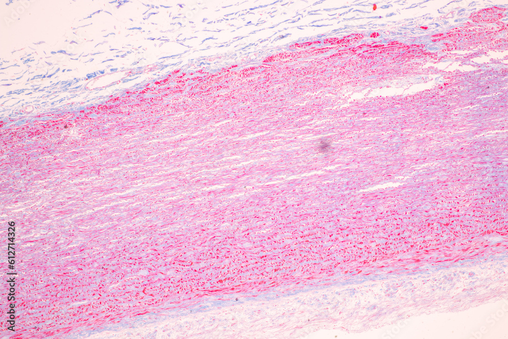 Tissue of Vein, Artery and Aorta Human under the microscope in Lab ...