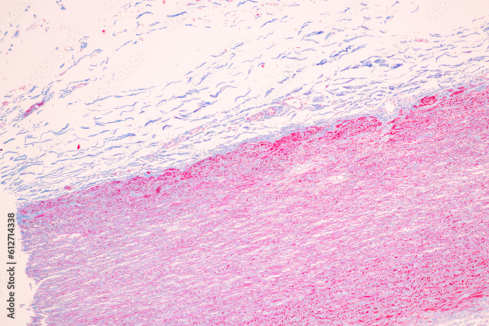 Foto de Tissue of Vein, Artery and Aorta Human under the microscope in ...