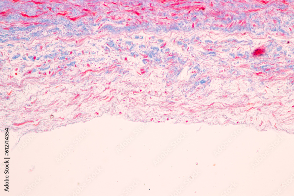 Foto de Tissue of Vein, Artery and Aorta Human under the microscope in ...