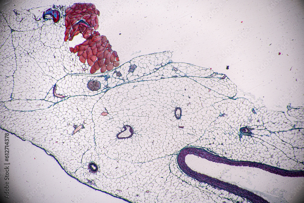 Tissue of Vein, Artery and Aorta Human under the microscope in Lab ...