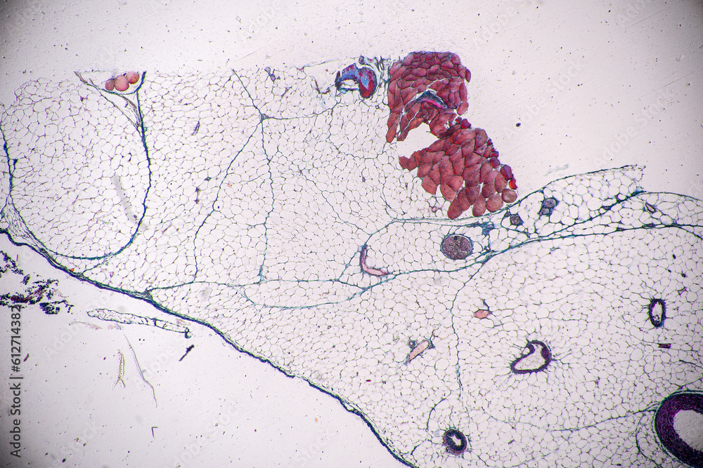 Tissue of Vein, Artery and Aorta Human under the microscope in Lab ...