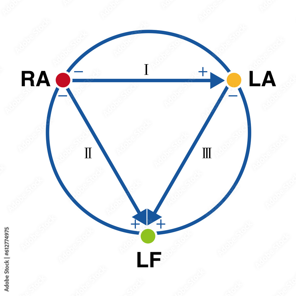 Assuming that the left upper limb, right upper limb, and left lower ...