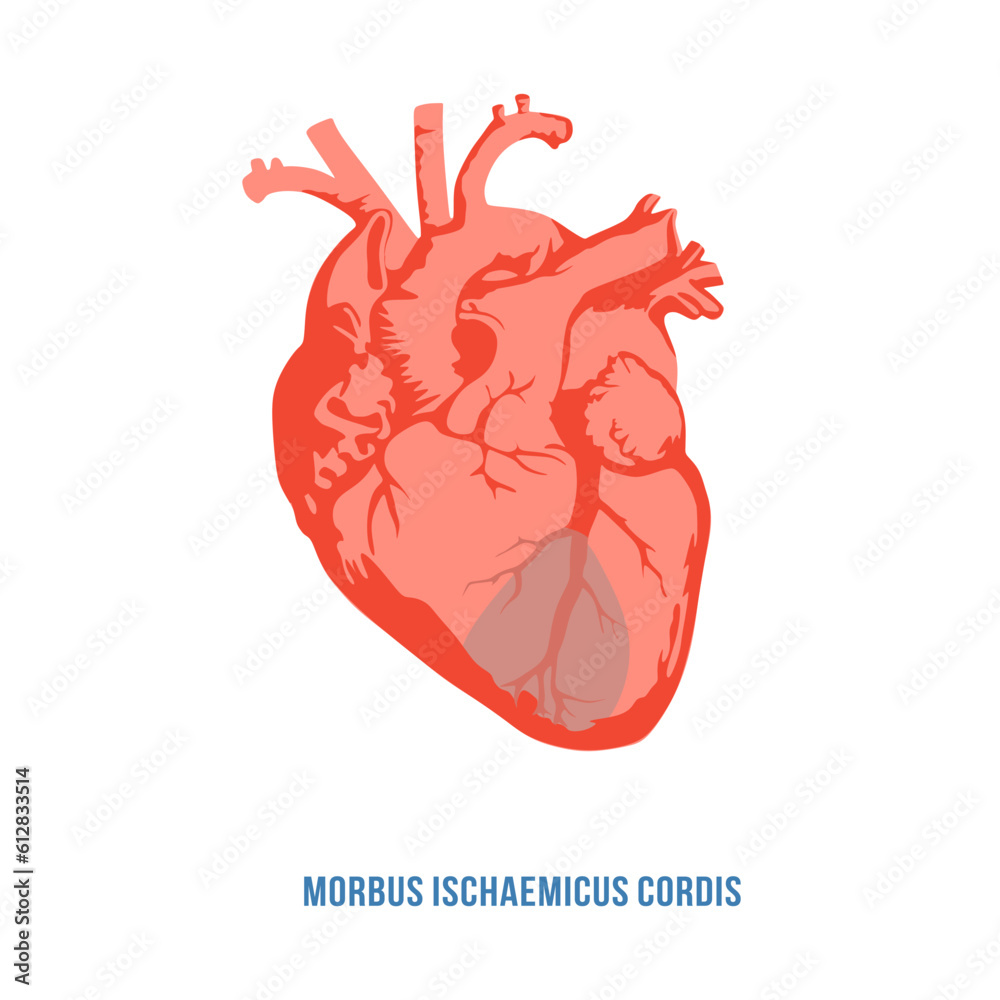 Real Unhealthy Human Heart