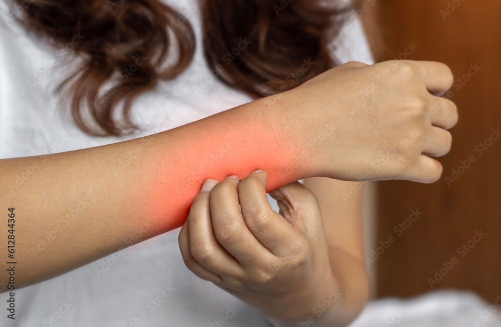 Asian woman scratching lower arm. Itchy skin diseases such as scabies ...