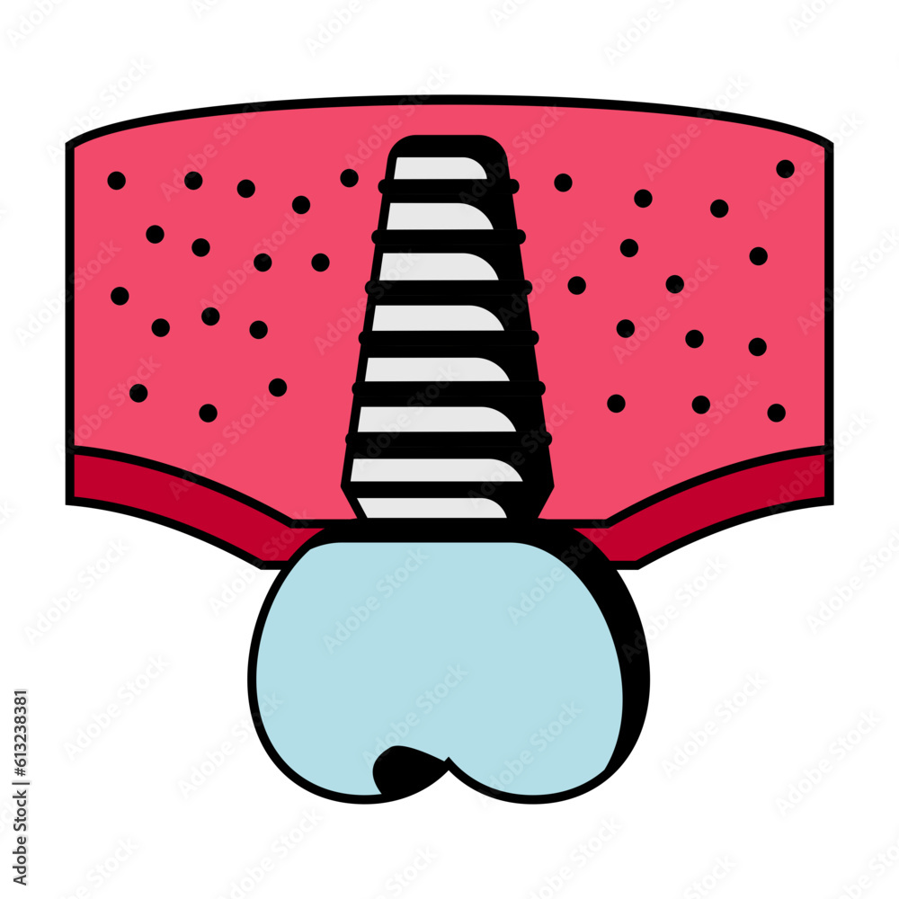 Dental Implant concept, artificial prosthetic tooth root vector icon ...