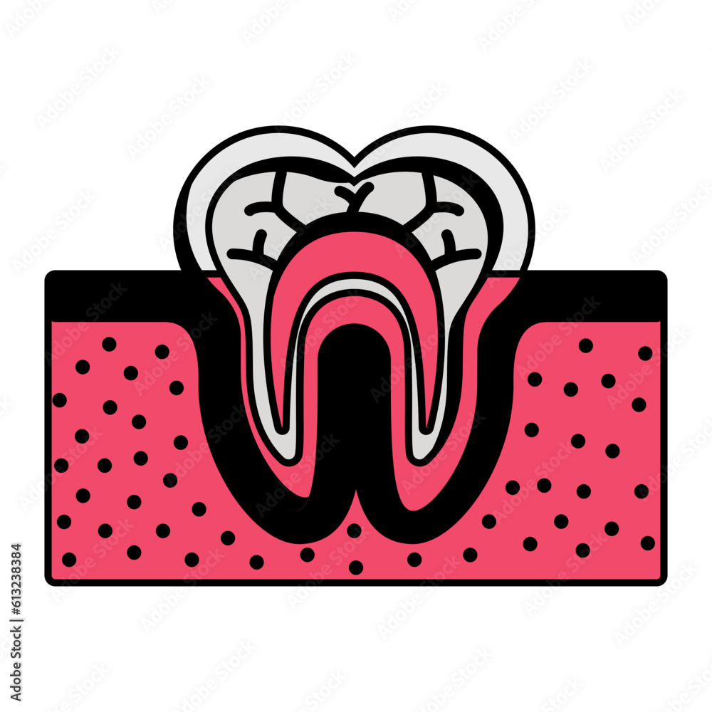 Gingivitis concept, swollen gum around teeth vector icon design ...